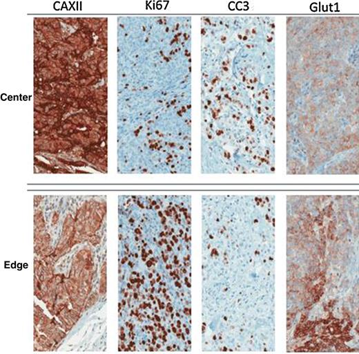 Eradicating Metastatic Cancer and the Eco-Evolutionary Dynamics of ...