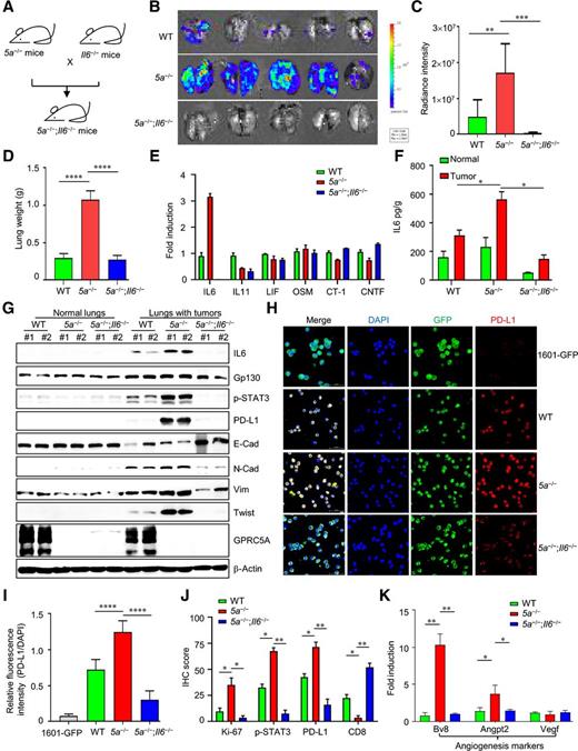 IL6/STAT3 Signaling Orchestrates Premetastatic Niche Formation and ...