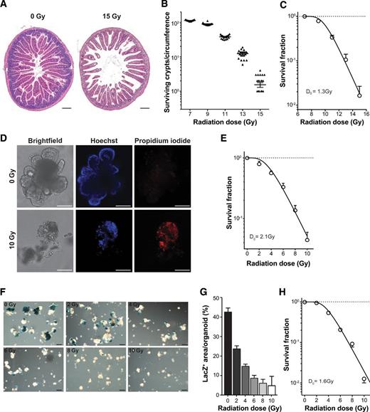 Organoids Reveal That Inherent Radiosensitivity of Small and Large ...