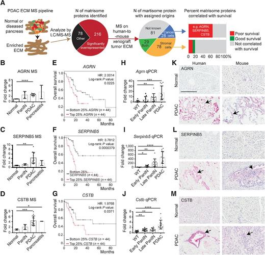 Cancer Cell–Derived Matrisome Proteins Promote Metastasis in Pancreatic Ductal Adenocarcinoma ...