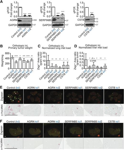 Cancer Cell–Derived Matrisome Proteins Promote Metastasis in Pancreatic ...