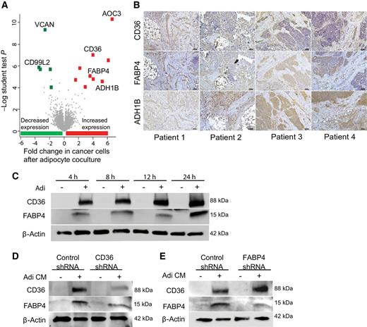 Adipocyte-Induced FABP4 Expression in Ovarian Cancer Cells Promotes ...