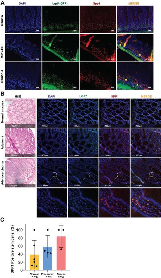 The Transcriptomic Landscape of Mismatch Repair-Deficient Intestinal ...