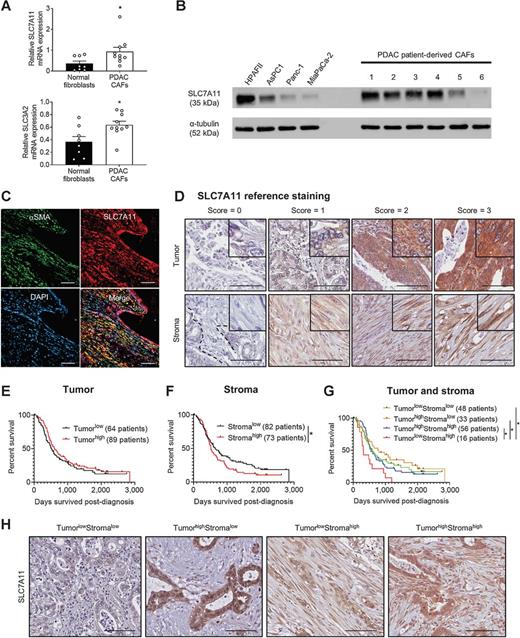 Cancer-Associated Fibroblasts in Pancreatic Ductal Adenocarcinoma ...