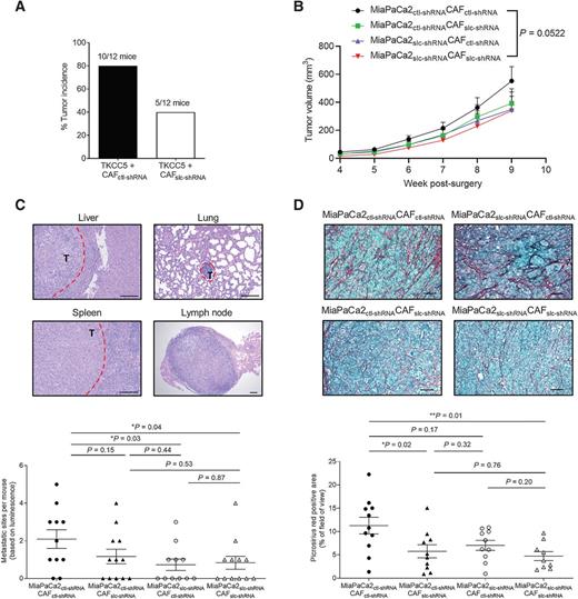 Cancer-Associated Fibroblasts in Pancreatic Ductal Adenocarcinoma ...