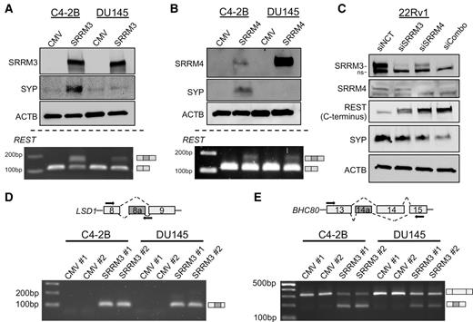 RNA Splicing Factors SRRM3 and SRRM4 Distinguish Molecular Phenotypes ...