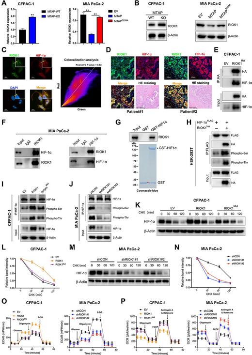 MTAP Deficiency–Induced Metabolic Reprogramming Creates a Vulnerability ...