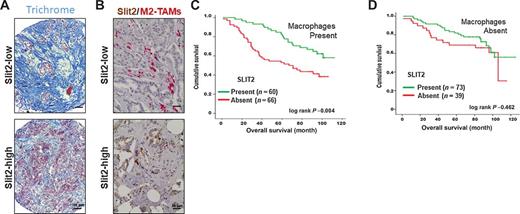 Slit2 Inhibits Breast Cancer Metastasis by Activating M1-Like ...