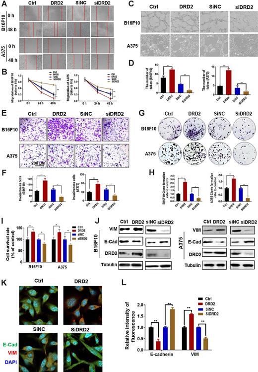 Psychologic Stress Drives Progression of Malignant Tumors via DRD2 ...