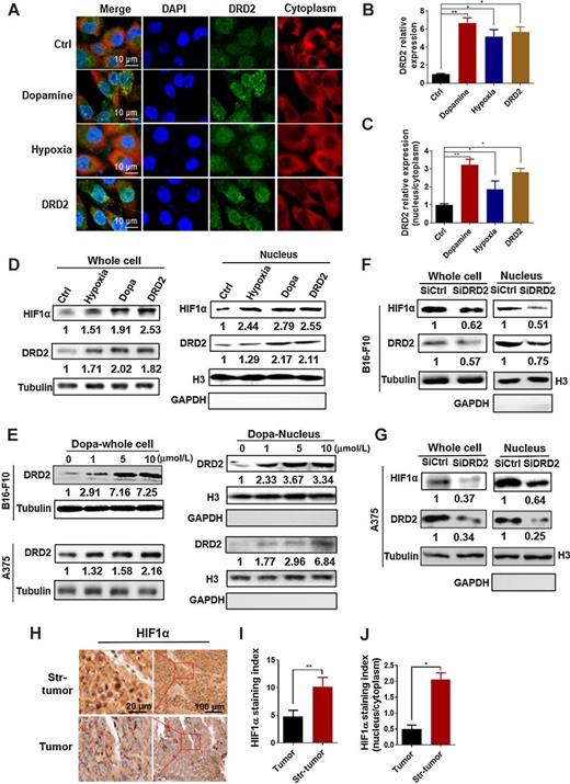 Psychologic Stress Drives Progression of Malignant Tumors via DRD2 ...