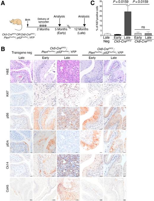 Novel Mouse Models of Bladder Cancer Identify a Prognostic Signature ...