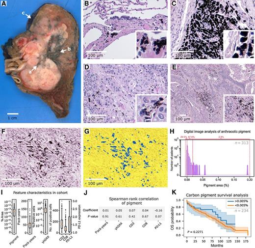 Patterns of Carbon-Bound Exogenous Compounds in Patients with Lung ...