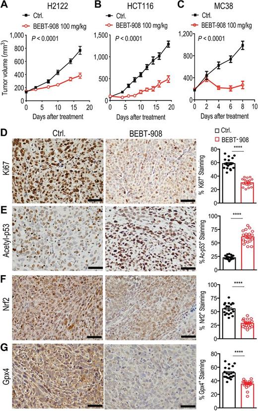 A Dual PI3K/HDAC Inhibitor Induces Immunogenic Ferroptosis to ...