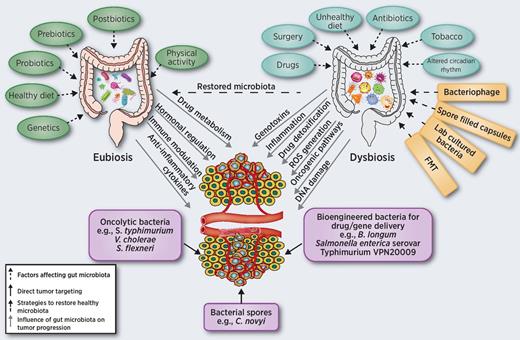 The Microbiome and Cancer: Creating Friendly Neighborhoods and Removing ...