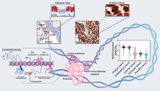 Unraveling the Mysteries of PAX8 in Reproductive Tract Cancers | Cancer ...