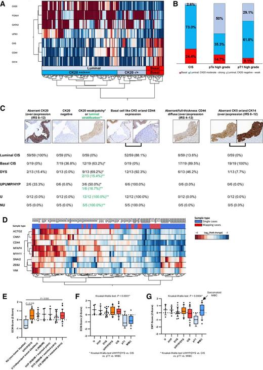 Bladder Tumor Subtype Commitment Occurs in Carcinoma In Situ Driven by ...