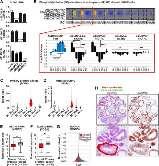 ELOVL5 Is a Critical and Targetable Fatty Acid Elongase in Prostate ...