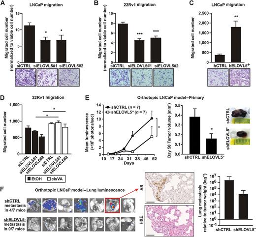 ELOVL5 Is a Critical and Targetable Fatty Acid Elongase in Prostate ...