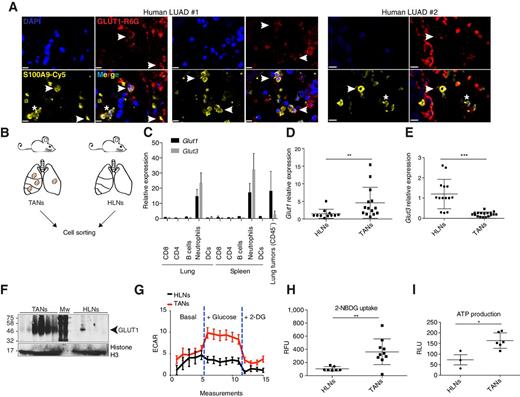 GLUT1 Expression in Tumor-Associated Neutrophils Promotes Lung Cancer ...