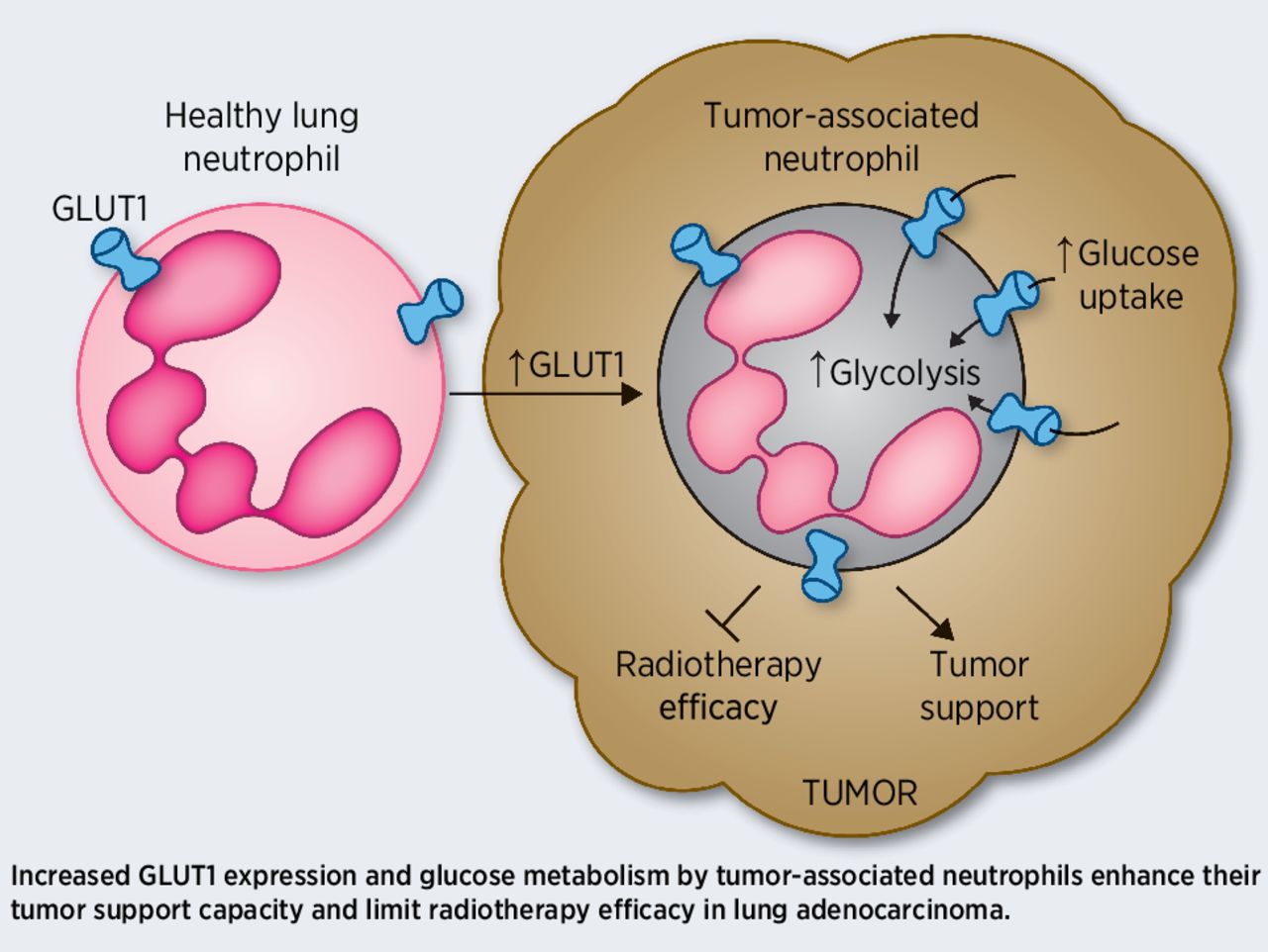 GLUT1 Expression in Tumor-Associated Neutrophils Promotes Lung Cancer ...