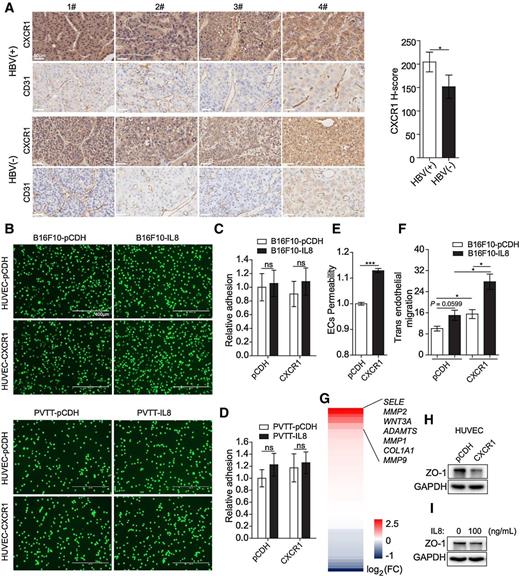 Hepatitis B–Induced IL8 Promotes Hepatocellular Carcinoma Venous ...
