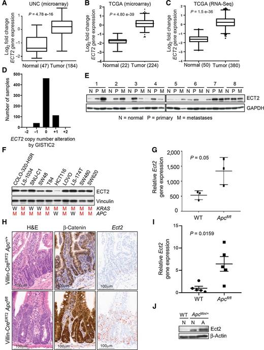 Aberrant Expression and Subcellular Localization of ECT2 Drives ...