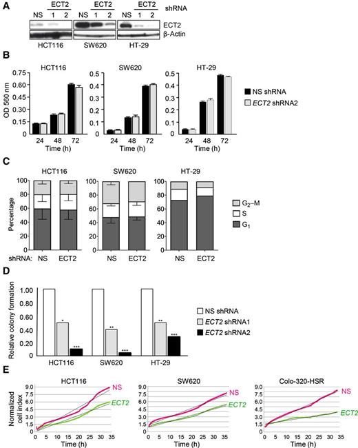 Aberrant Expression and Subcellular Localization of ECT2 Drives ...