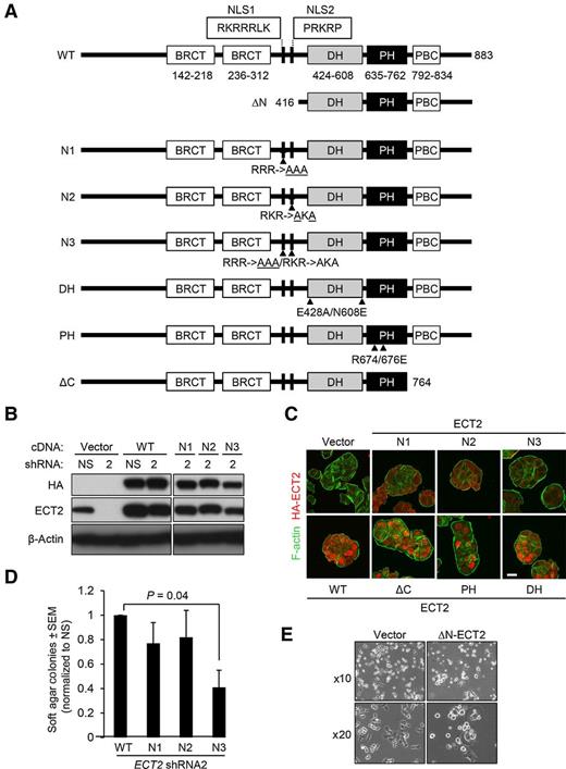 Aberrant Expression and Subcellular Localization of ECT2 Drives ...