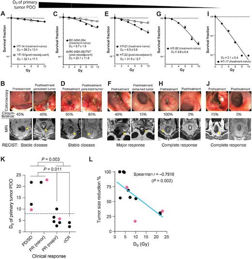 Colorectal Cancer Develops Inherent Radiosensitivity That Can Be ...