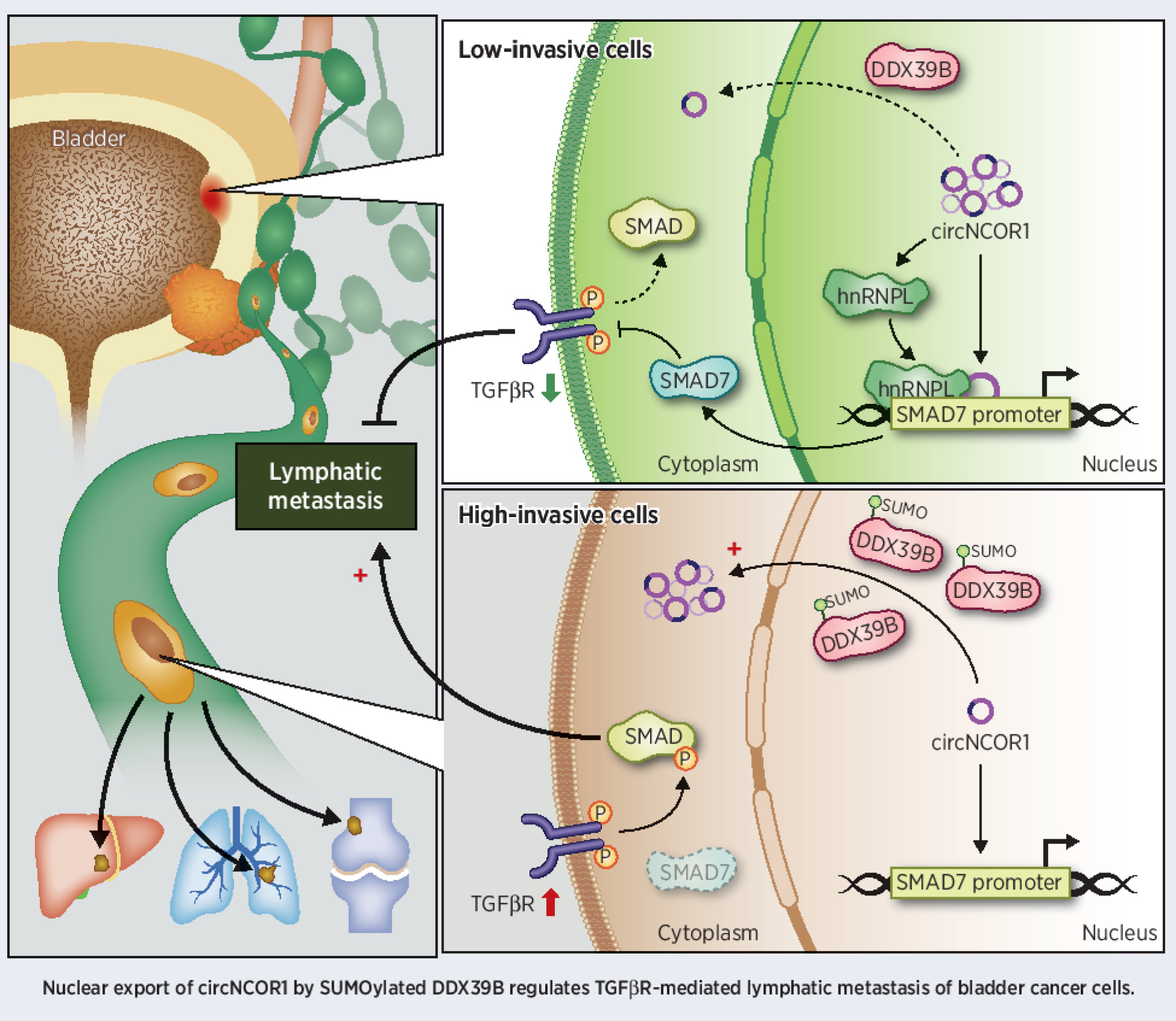 Aberrant Nuclear Export of circNCOR1 Underlies SMAD7-Mediated Lymph ...