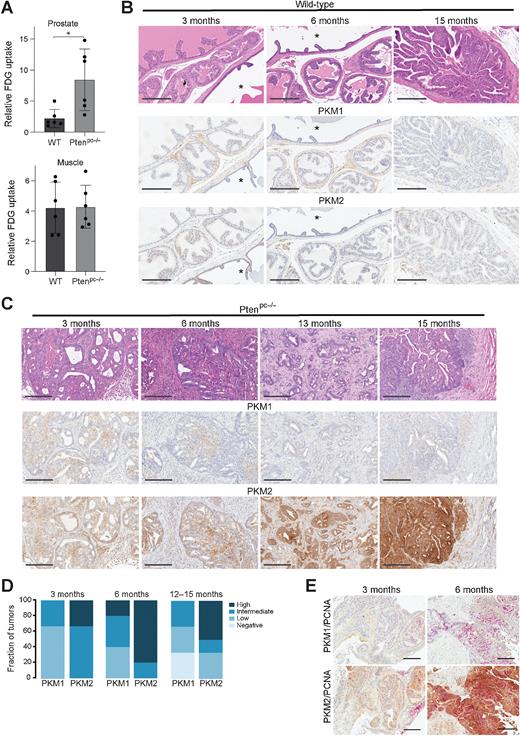 Pyruvate Kinase M1 Suppresses Development and Progression of Prostate ...