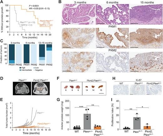 Pyruvate Kinase M1 Suppresses Development and Progression of Prostate ...