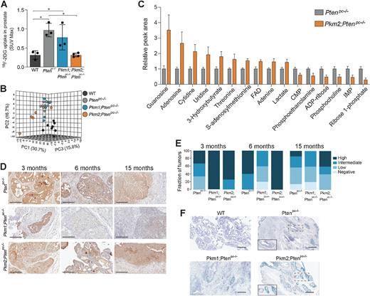 Pyruvate Kinase M1 Suppresses Development and Progression of Prostate ...