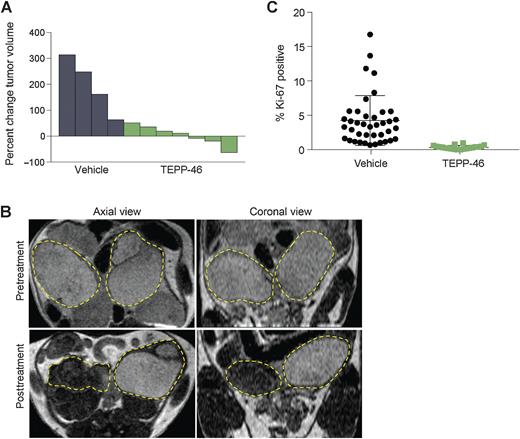 Pyruvate Kinase M1 Suppresses Development and Progression of Prostate ...
