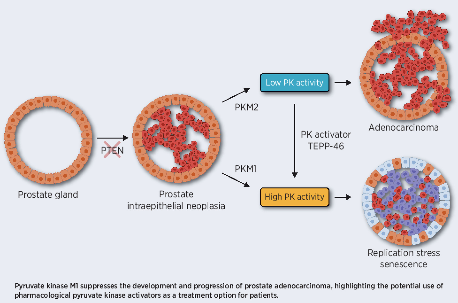 Pyruvate Kinase M1 Suppresses Development and Progression of Prostate ...