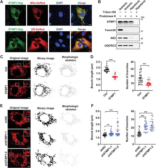 Mitochondrial Micropeptide STMP1 Enhances Mitochondrial Fission to ...