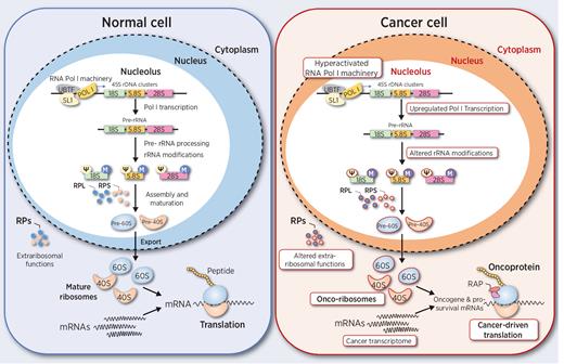 Ribosome Biogenesis: A Central Player in Cancer Metastasis and ...