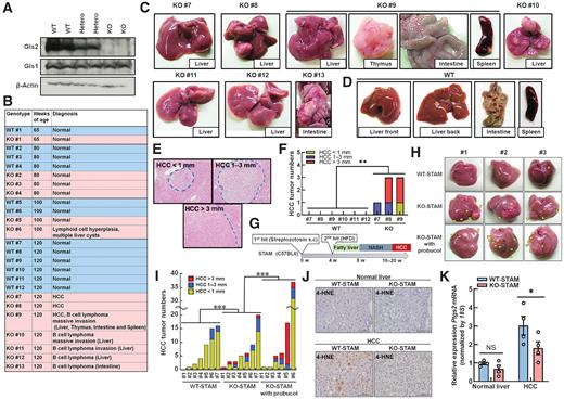 GLS2 Is a Tumor Suppressor and a Regulator of Ferroptosis in ...