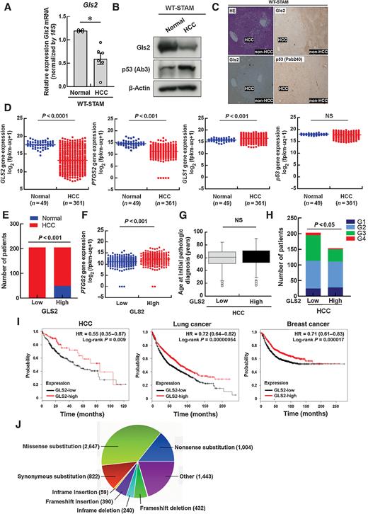 GLS2 Is a Tumor Suppressor and a Regulator of Ferroptosis in ...