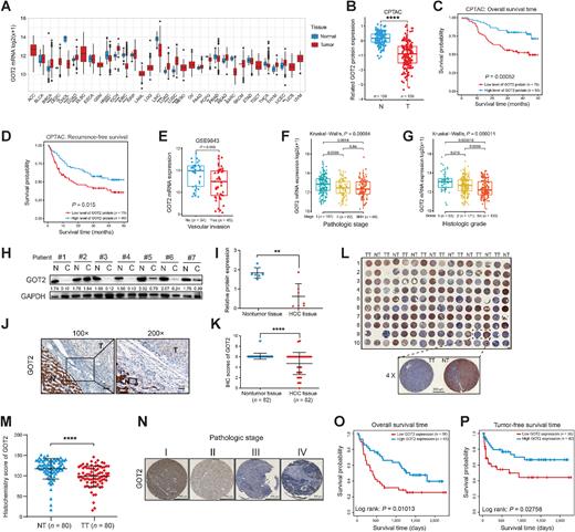 GOT2 Silencing Promotes Reprogramming of Glutamine Metabolism and ...