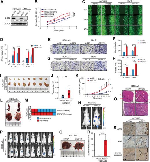 GOT2 Silencing Promotes Reprogramming of Glutamine Metabolism and ...