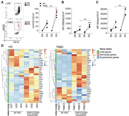 Lipid-Associated Macrophages Are Induced by Cancer-Associated ...