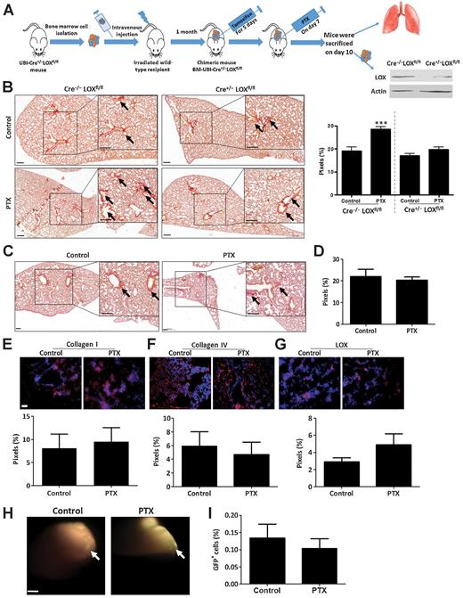 T Cells Promote Metastasis by Regulating Extracellular Matrix ...