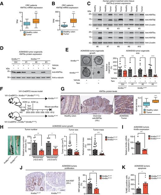 KMT9 Controls Stemness and Growth of Colorectal Cancer | Cancer ...