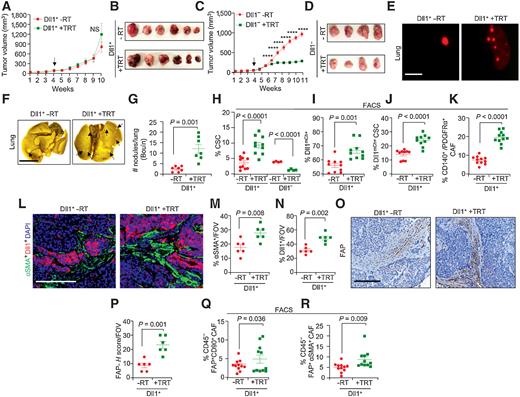 Dll1-Mediated Notch Signaling Drives Tumor Cell Cross-talk with Cancer ...