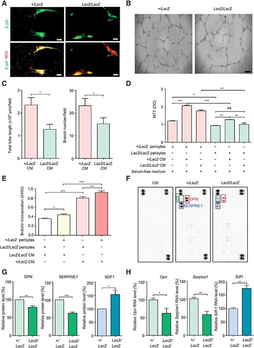 CD248 Regulates Wnt Signaling in Pericytes to Promote Angiogenesis and ...