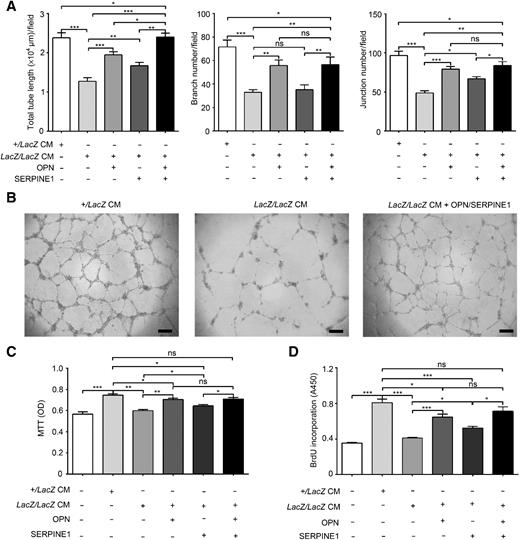 CD248 Regulates Wnt Signaling in Pericytes to Promote Angiogenesis and ...