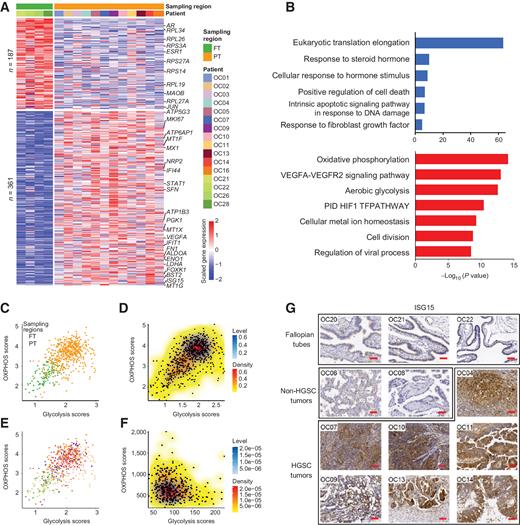 Single-Cell Dissection of the Multiomic Landscape of High-Grade Serous ...