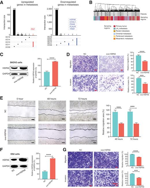Single-Cell Dissection of the Multiomic Landscape of High-Grade Serous ...