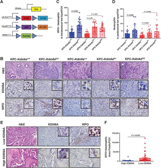 KDM6A Loss Recruits Tumor-Associated Neutrophils and Promotes ...